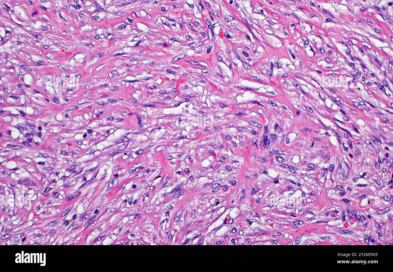 Light micrograph of fibroblasts. Fibroblasts are connective tissue ...