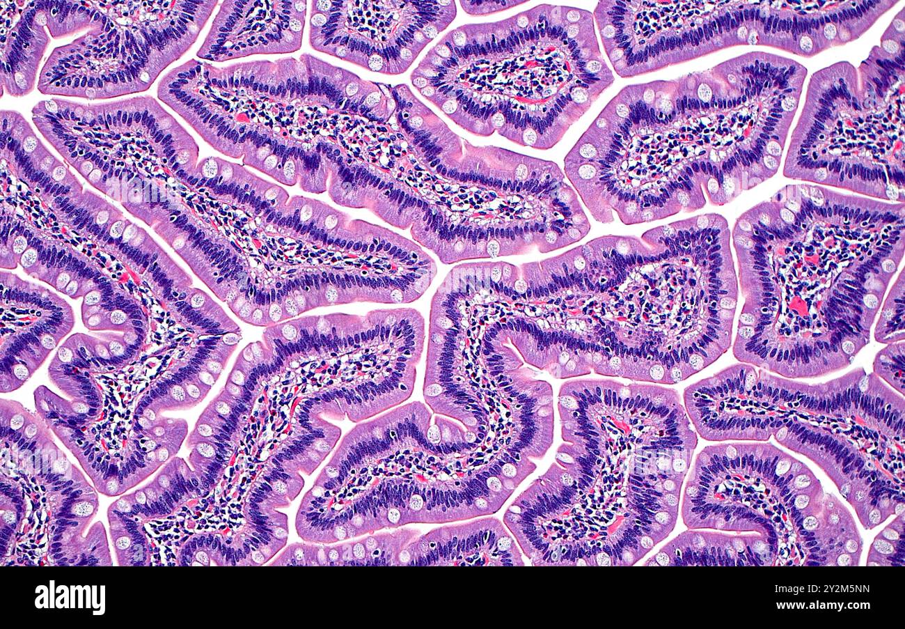 Light micrograph of a section of duodenal villi. The duodenal villous ...