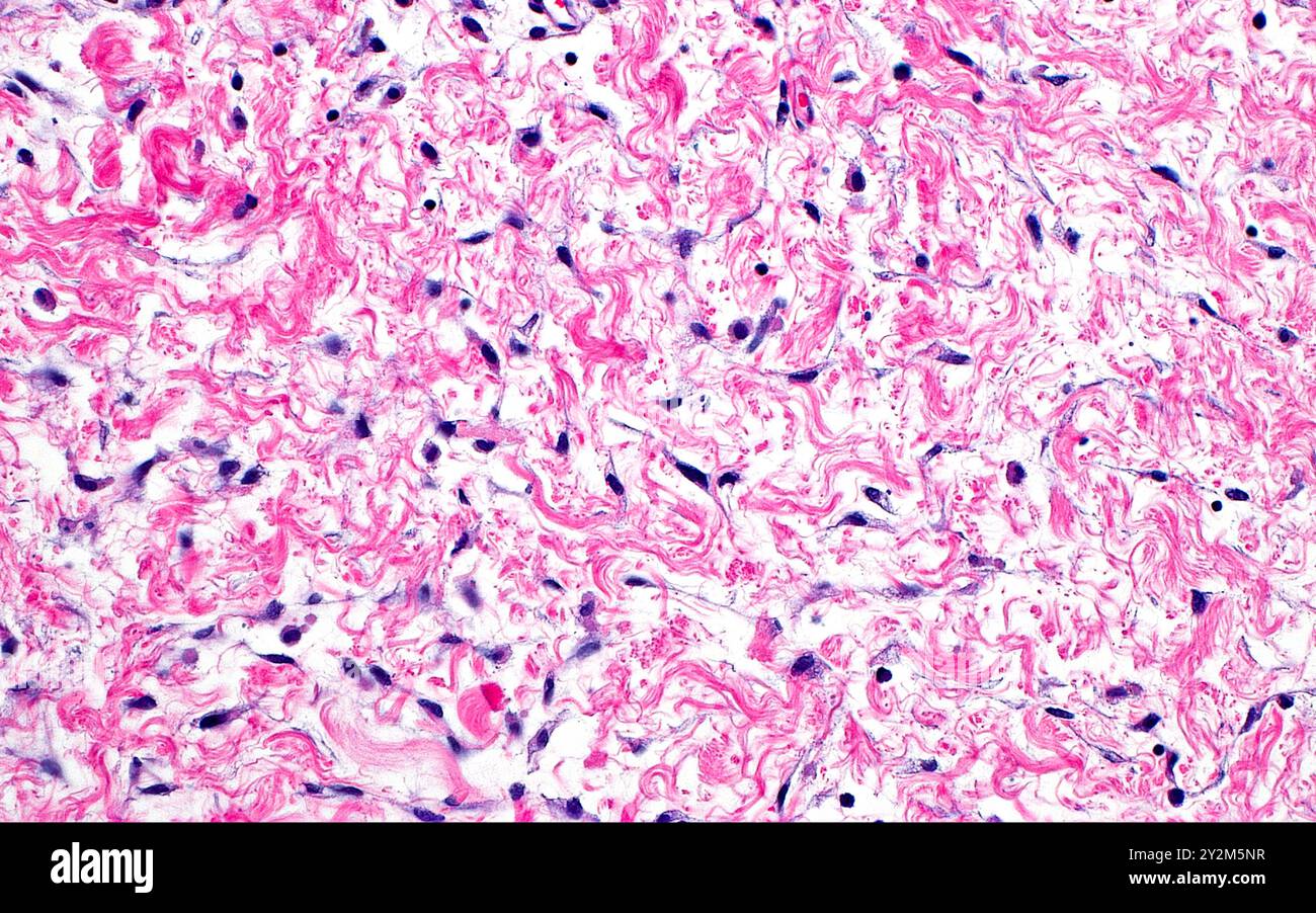 Light micrograph of fibroblasts. Fibroblasts are connective tissue ...