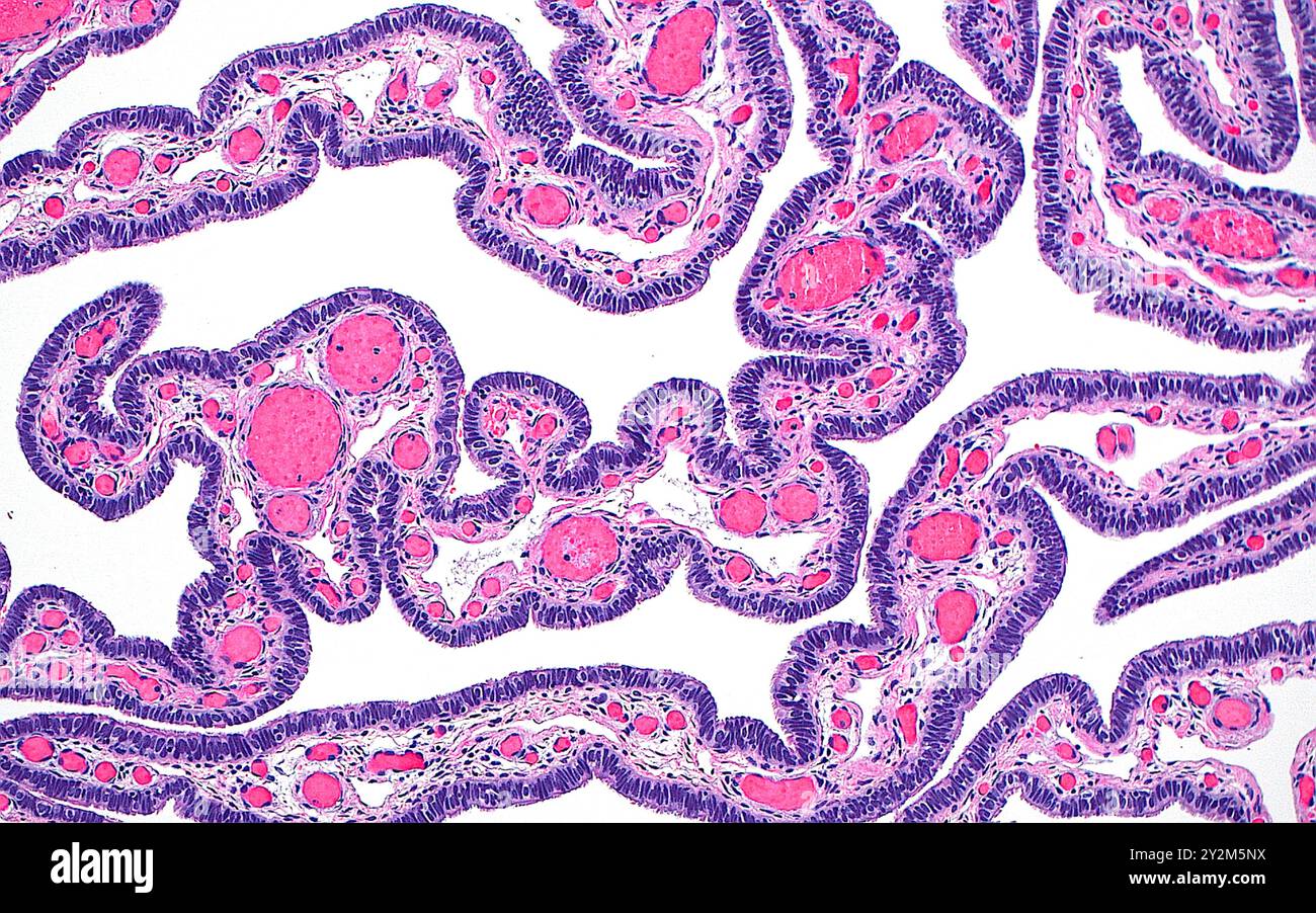 Light micrograph of fallopian tube fimbria. The fimbria are finger-like ...