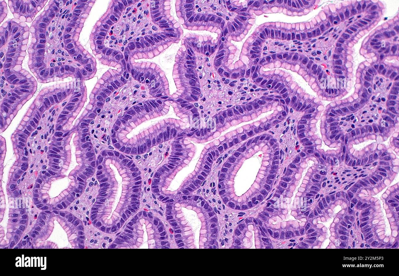 Light micrograph of gastric foveolar epithelium. The gastric epithelium ...