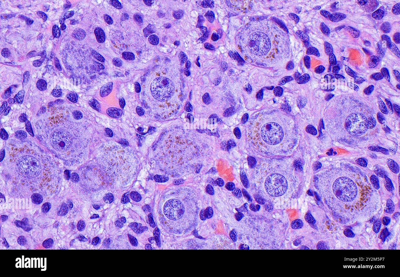 Light micrograph of ganglion cell bodies. Ganglion cells are part of ...