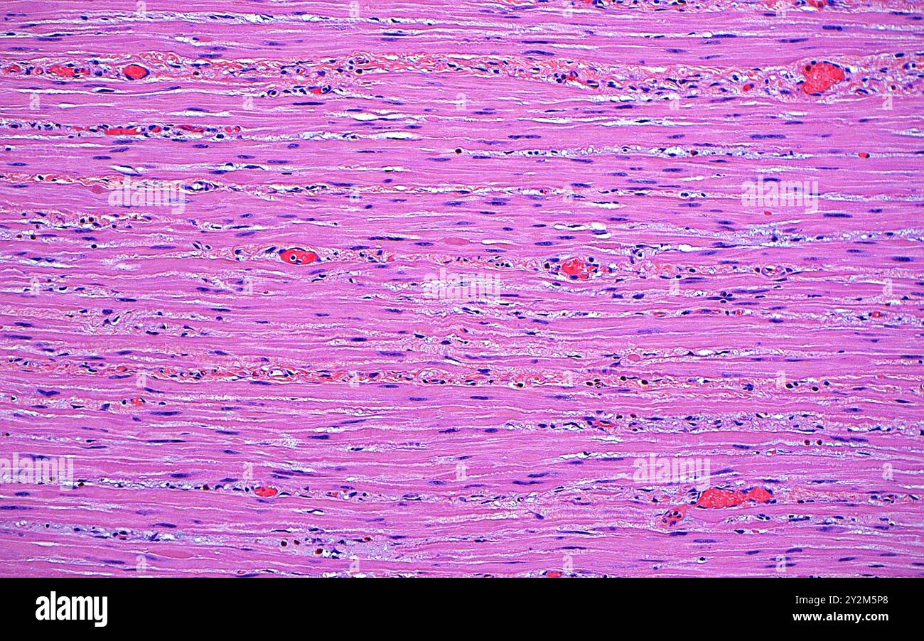 Light micrograph of large bowel smooth muscle. The wall of the large ...