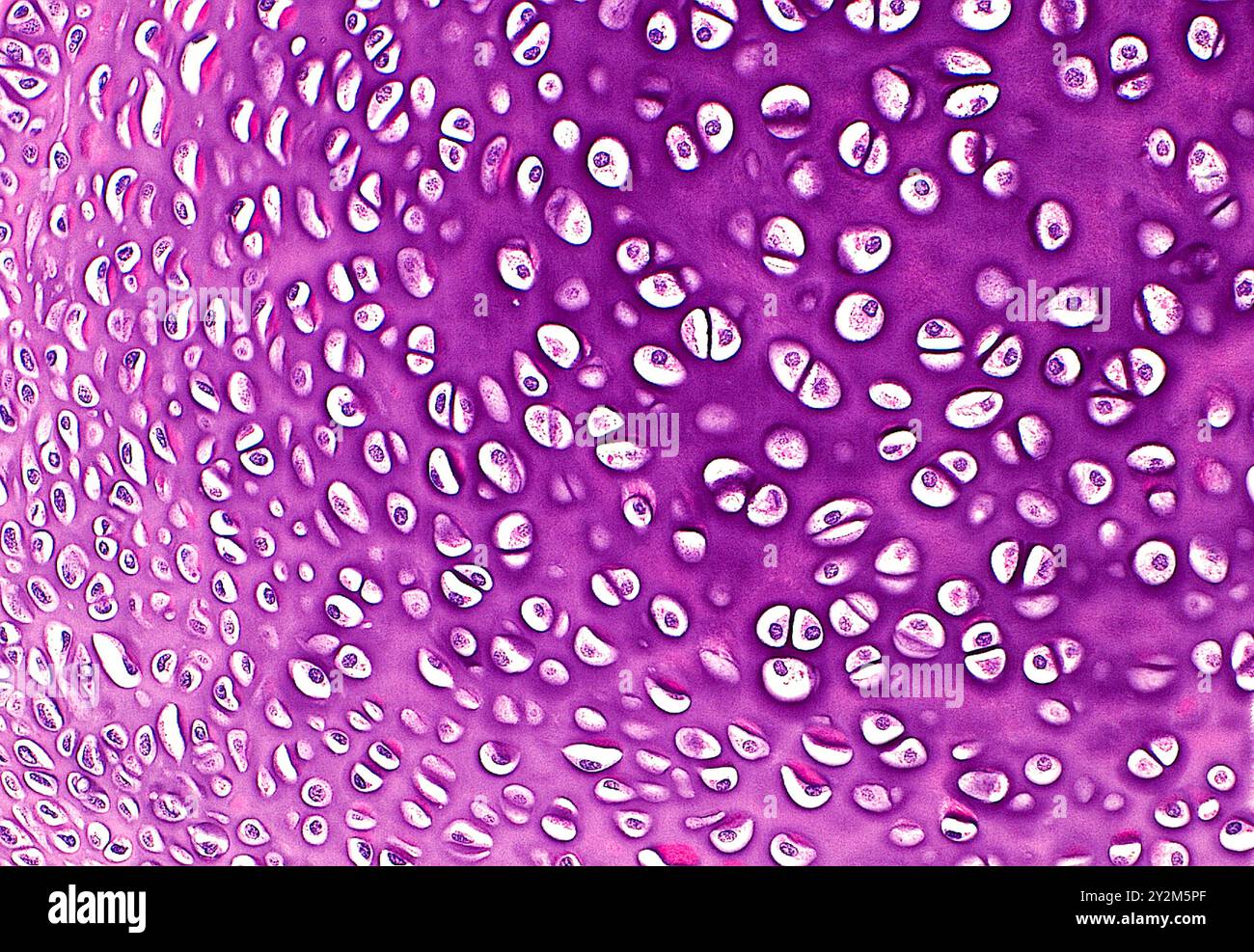 Light micrograph of hyaline cartilage. The cartilage is made up of ...