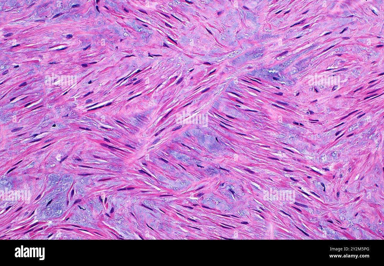 Light micrograph of intima of an arterial wall. The intima in this ...