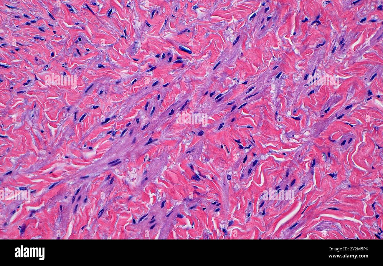 Light micrograph of a tangential cut through the capsule of the liver ...