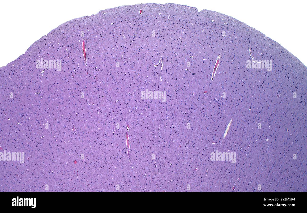 Light micrograph of the human frontal cortex. Haematoxylin and eosin ...