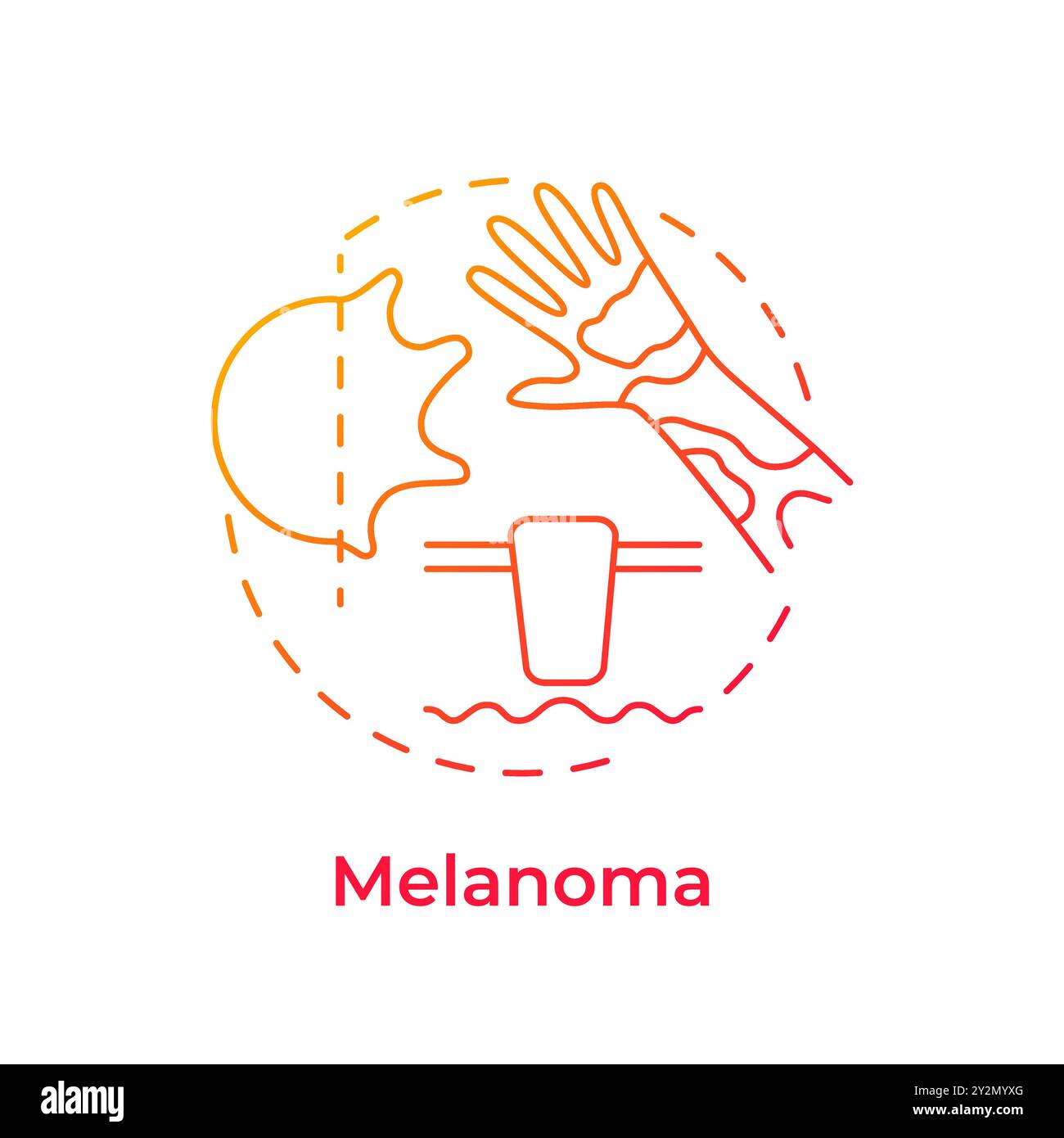Malignant melanoma skin cancer Stock Vector Images - Alamy