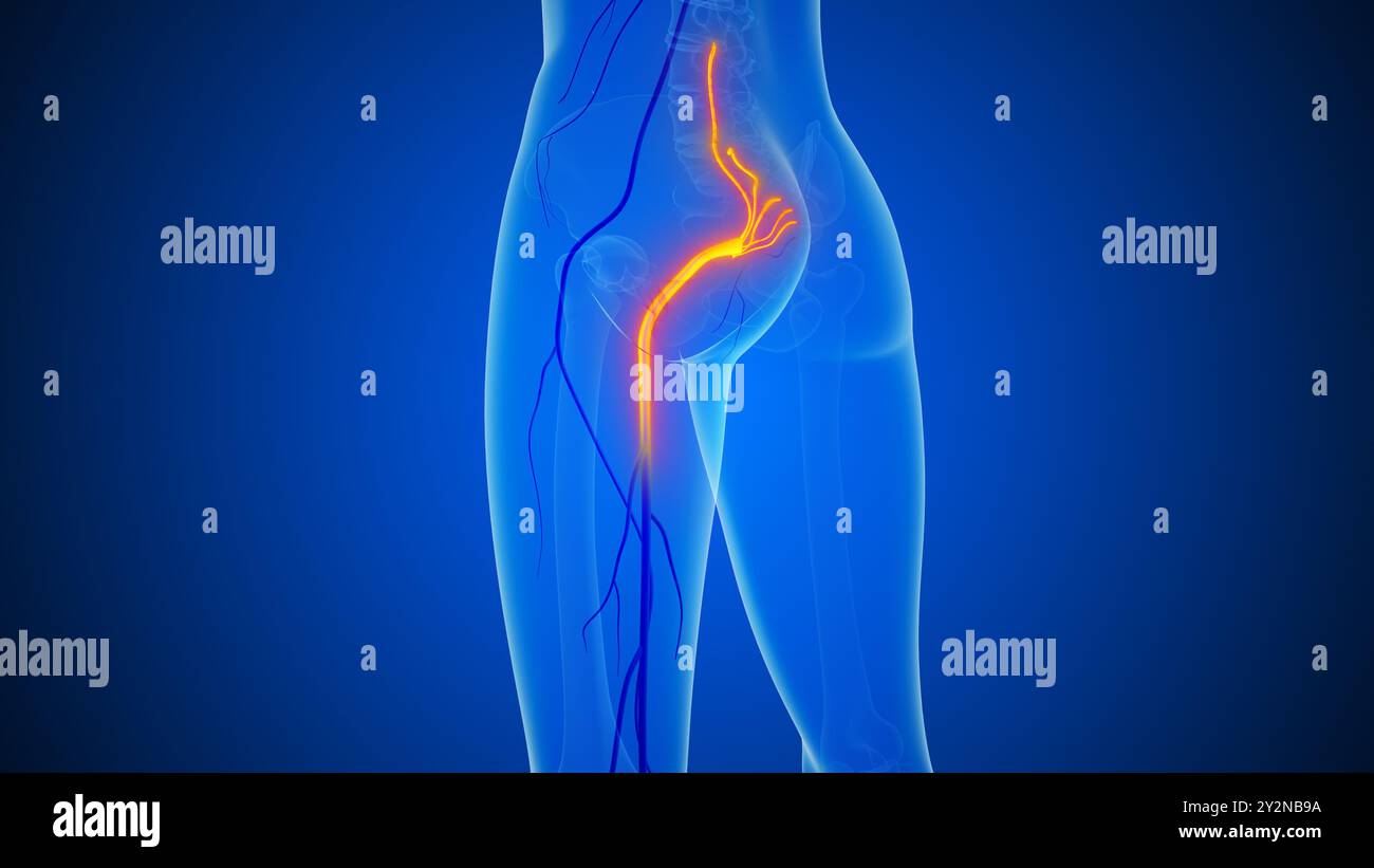 Sciatic spine and nerve pain medical concept Stock Photo - Alamy