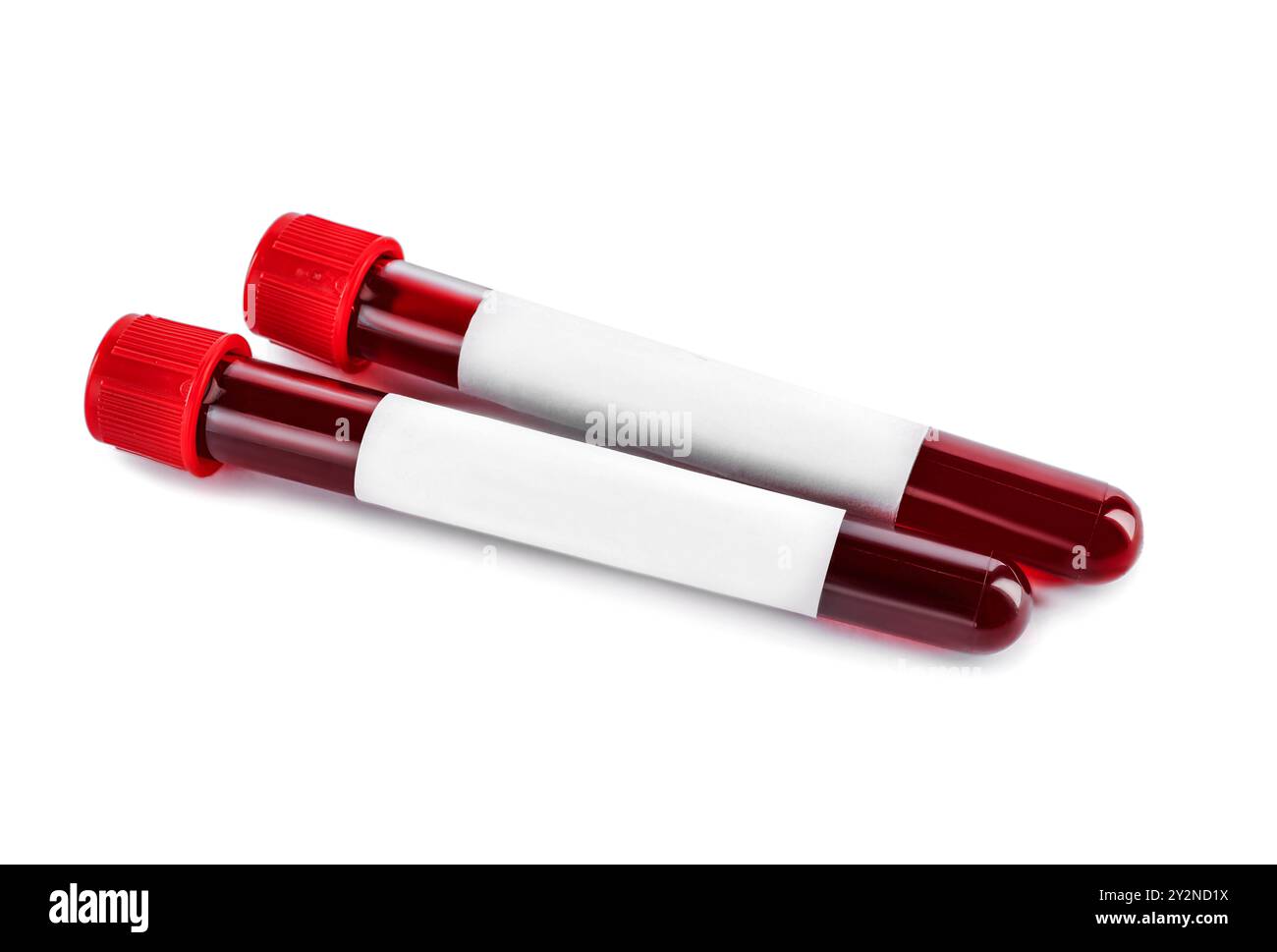Blood in test tubes with blank labels on white background. Medical ...