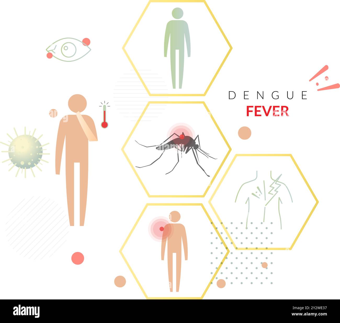 Dengue Fever (DENV) - Key Symptoms and Social Context - Stock ...