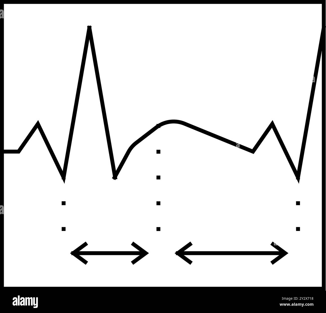 Diastole analysis sistal cardiogram hi-res stock photography and images ...