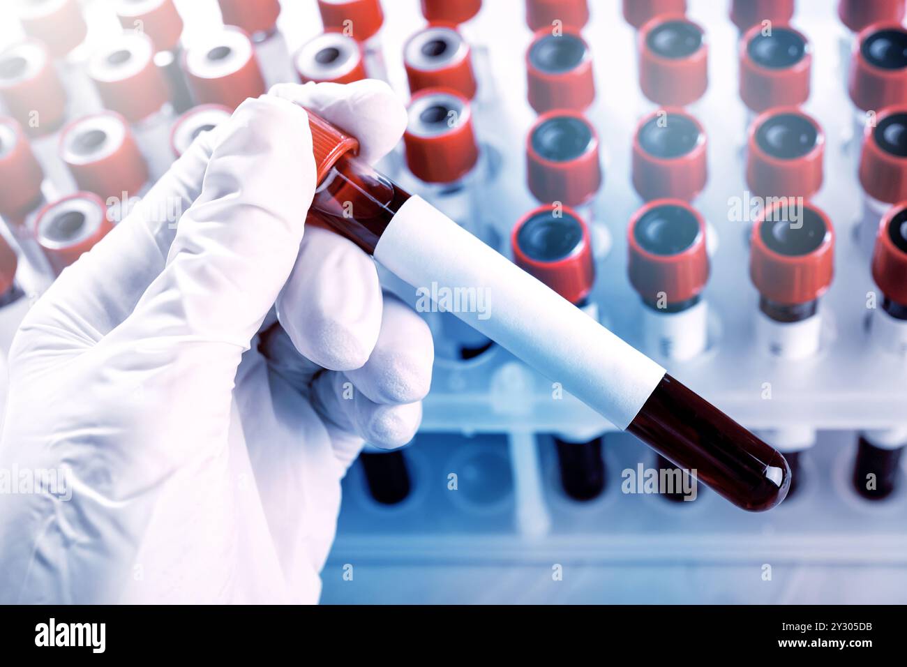 Laboratory worker putting sample tube with blood and blank label near ...
