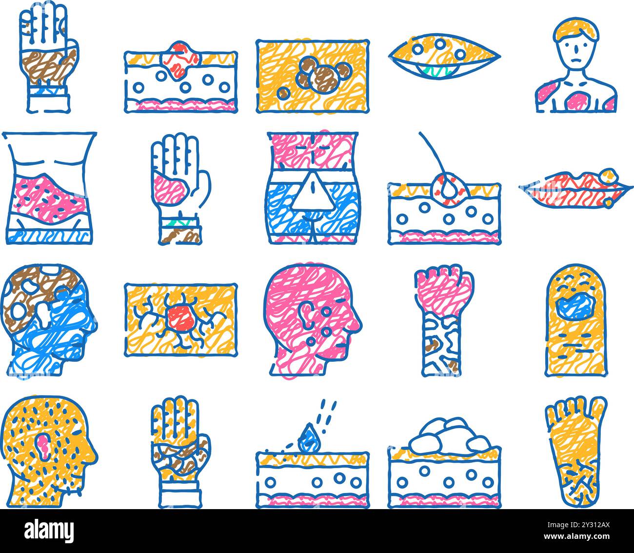 skin disease human health problem icon hand drawn Stock Vector Image ...