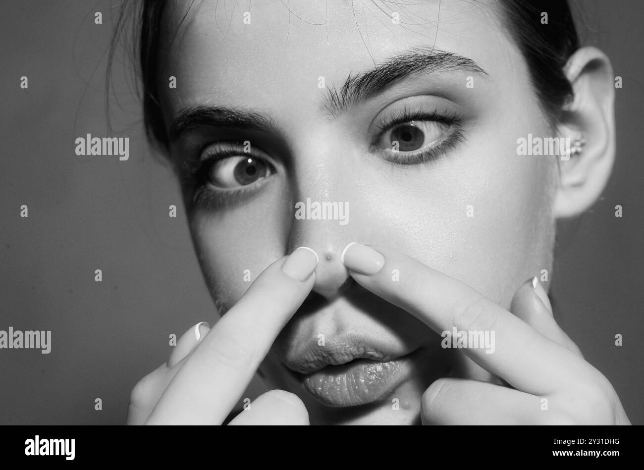 Close up Woman squeeze out pimples on nose. Acne and pimple on skin ...