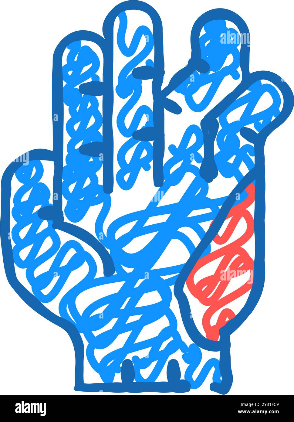 displaced fracture icon doodle illustration Stock Vector Image & Art ...