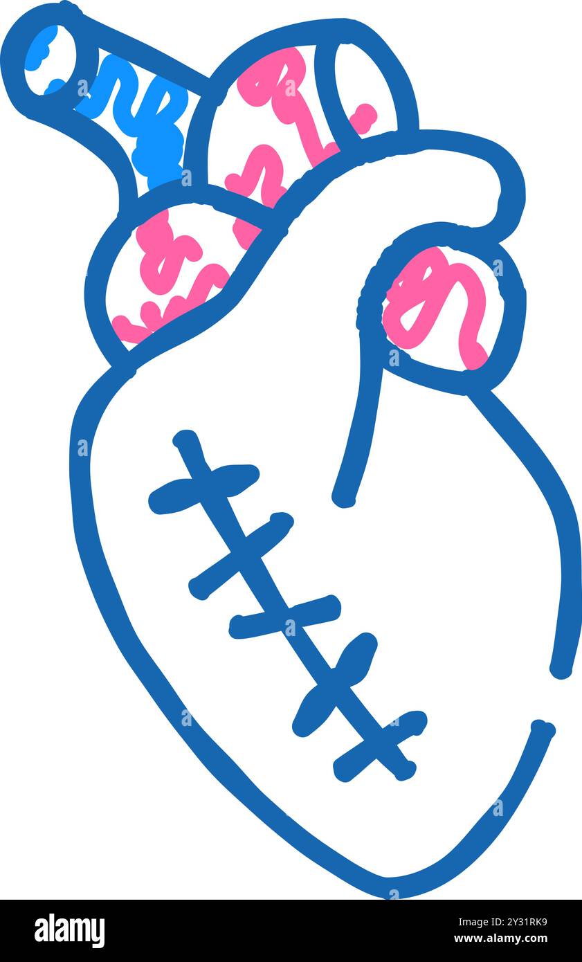 heart attack operation icon doodle illustration Stock Vector Image ...