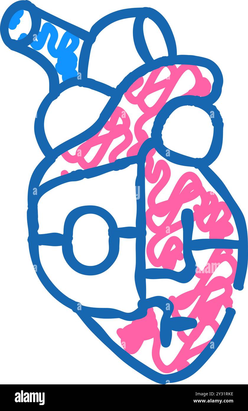 heart pacemaker sign icon doodle illustration Stock Vector Image & Art ...