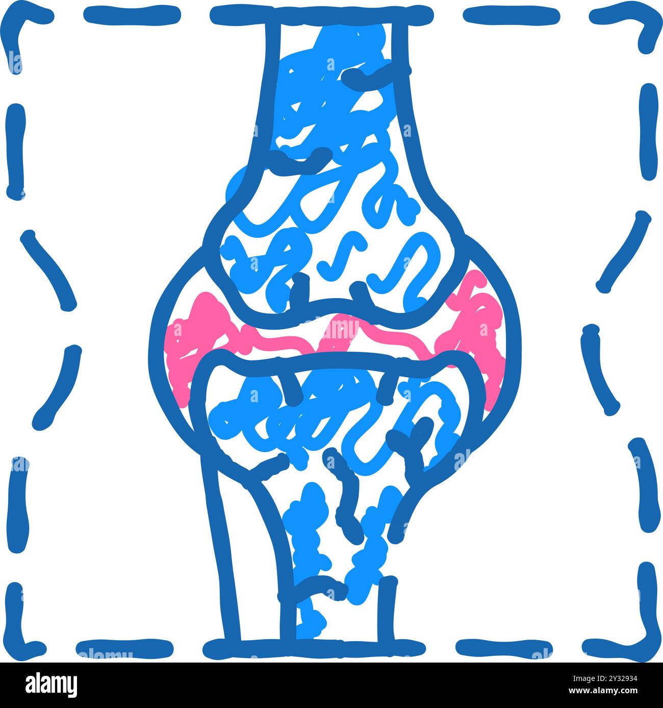 joint problem flat icon doodle illustration Stock Vector Image & Art ...