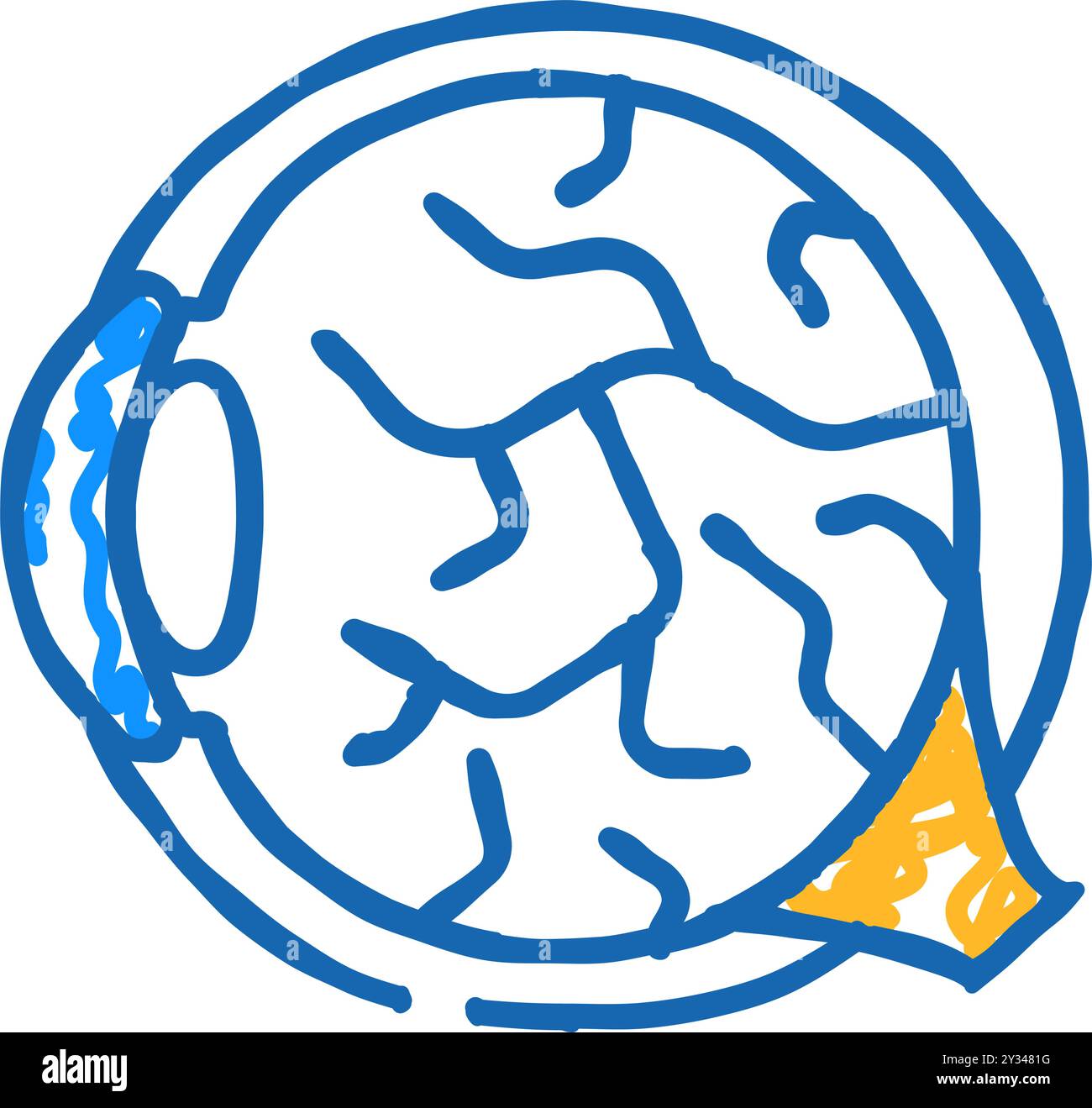 inflammation of eye ophthalmology icon doodle illustration Stock Vector ...