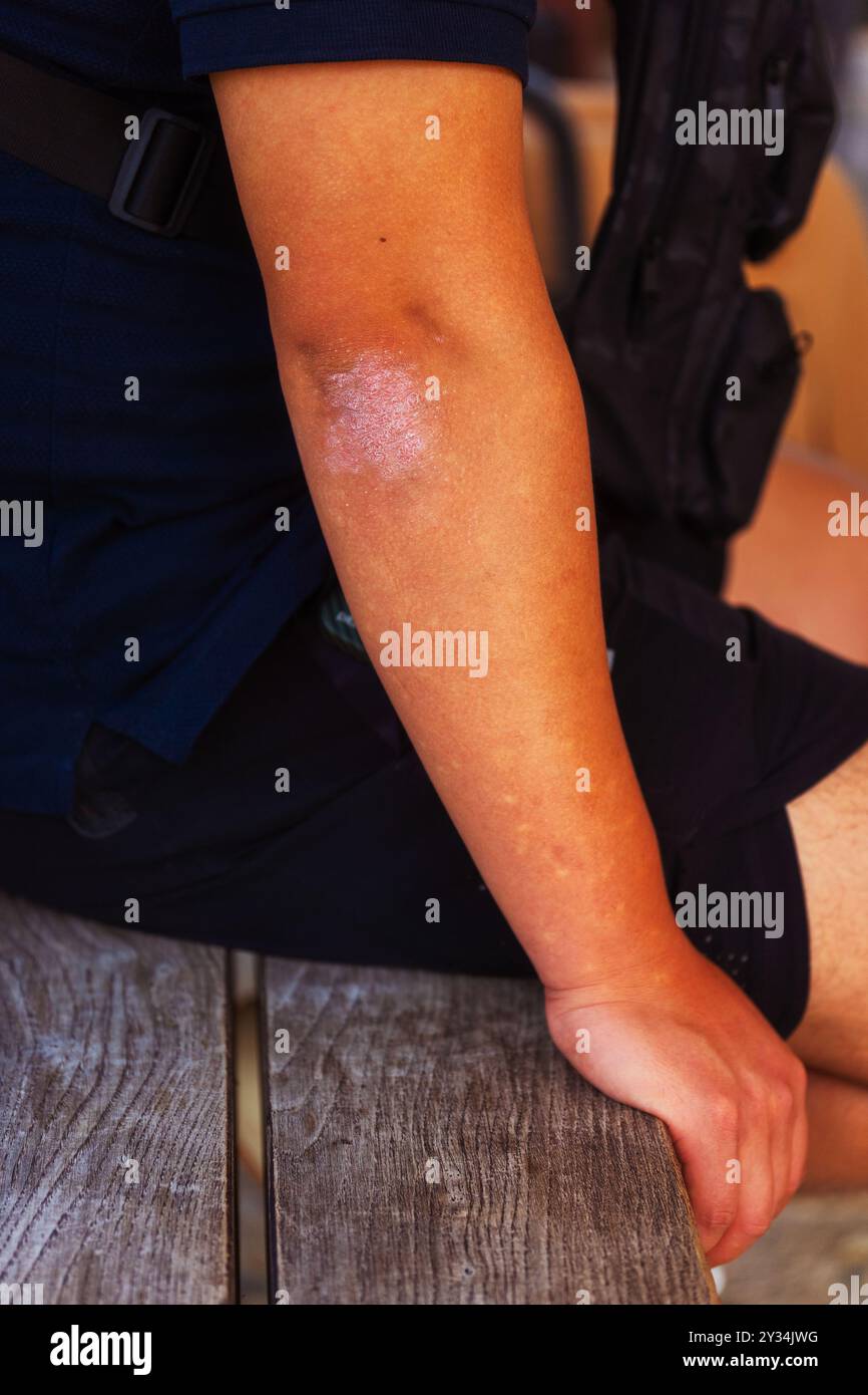 Skin condition assessment hi-res stock photography and images - Alamy