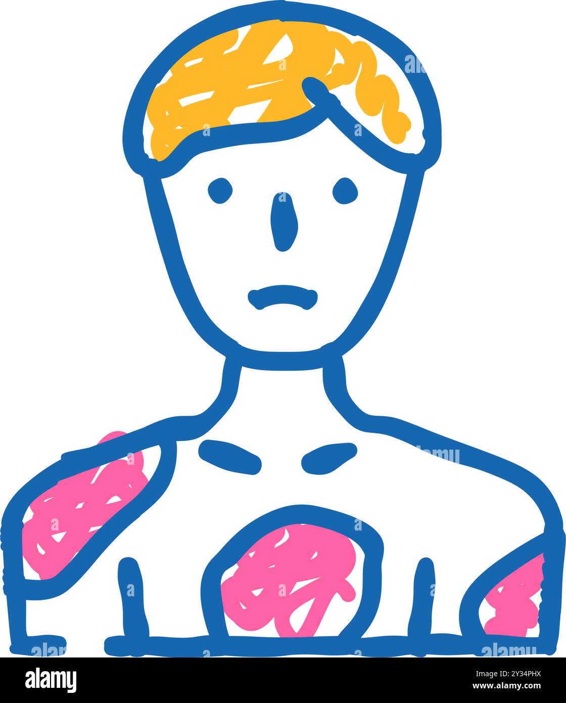 psoriasis skin illness icon doodle illustration Stock Vector Image ...