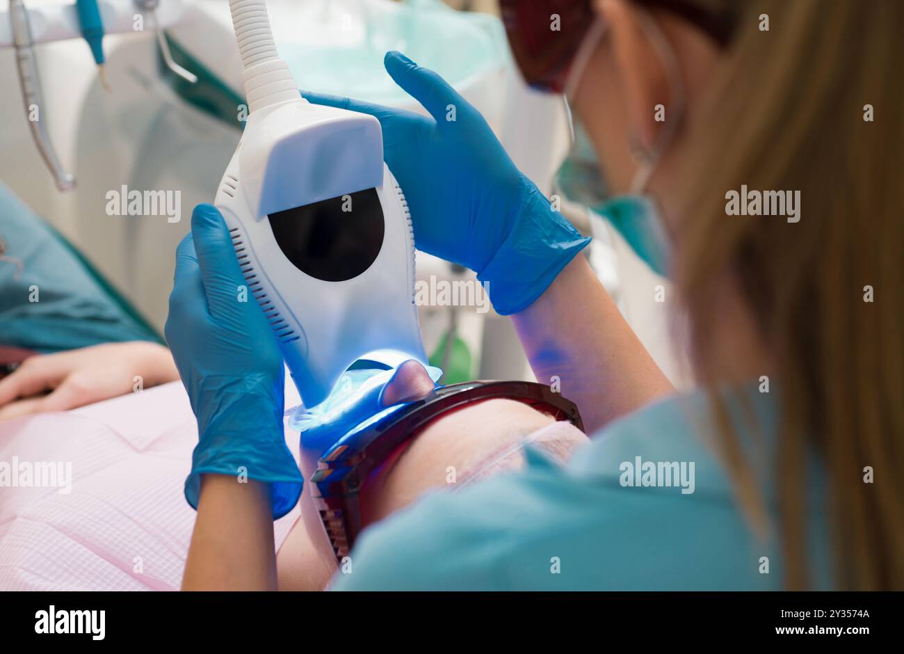 UV Whitening teeth. Remove decay from teeth and fill cavities. Tooth ...