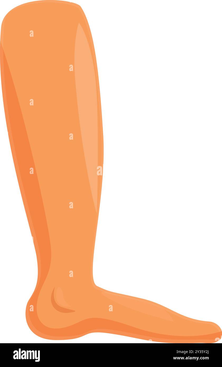 Human leg showing flat foot pathology illustration Stock Vector Image ...