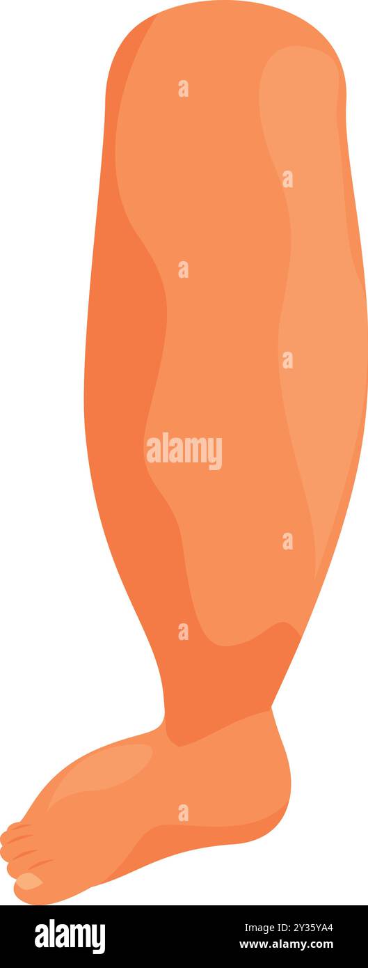 Cartoon illustration of a human leg showing swelling from the knee to ...