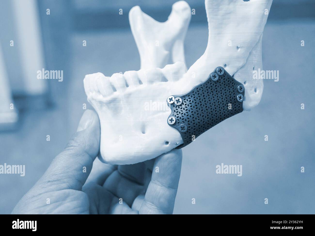 Person holding in hand prototype of lower human jaw with medical ...