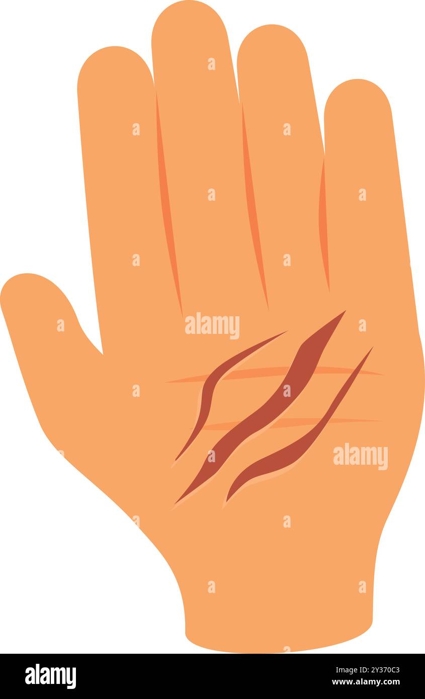 Cartoon illustration of a hand showing three deep scratch marks ...