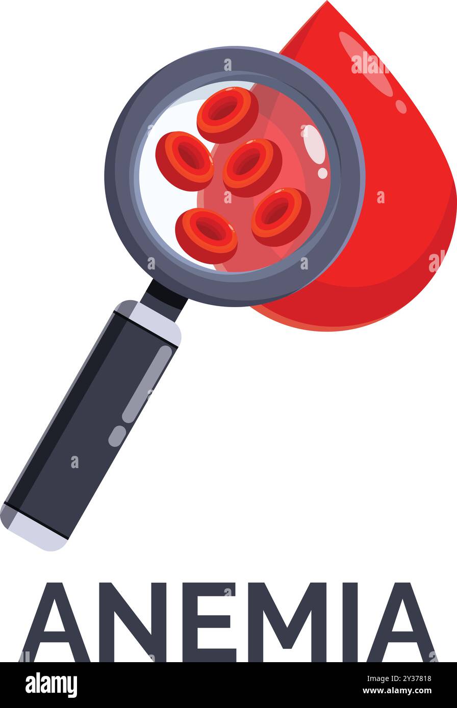 Magnifying glass showing red blood cells with anemia lettering, medical ...