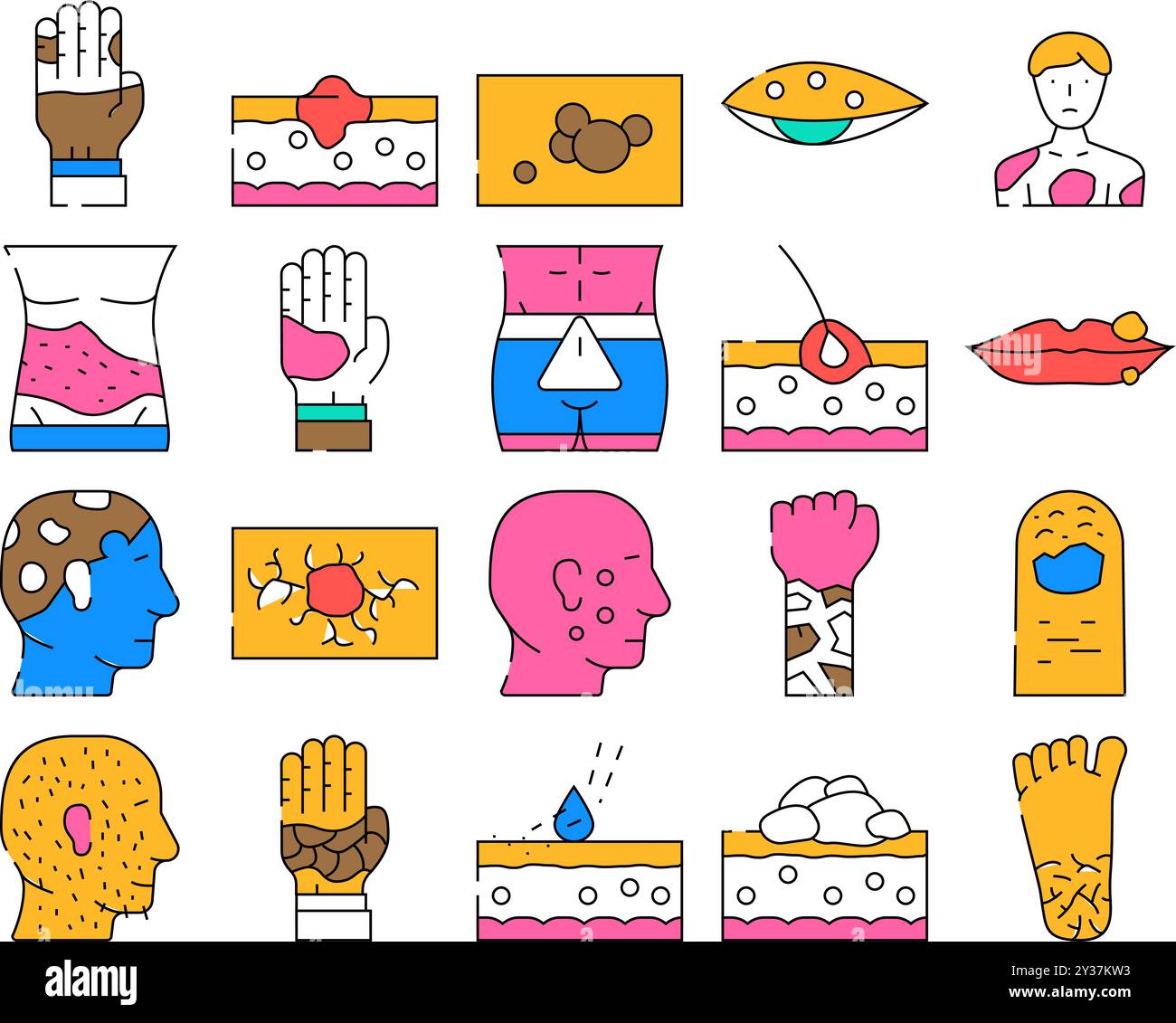 Skin Disease Human Health Problem Icons Set Vector Stock Vector Image ...
