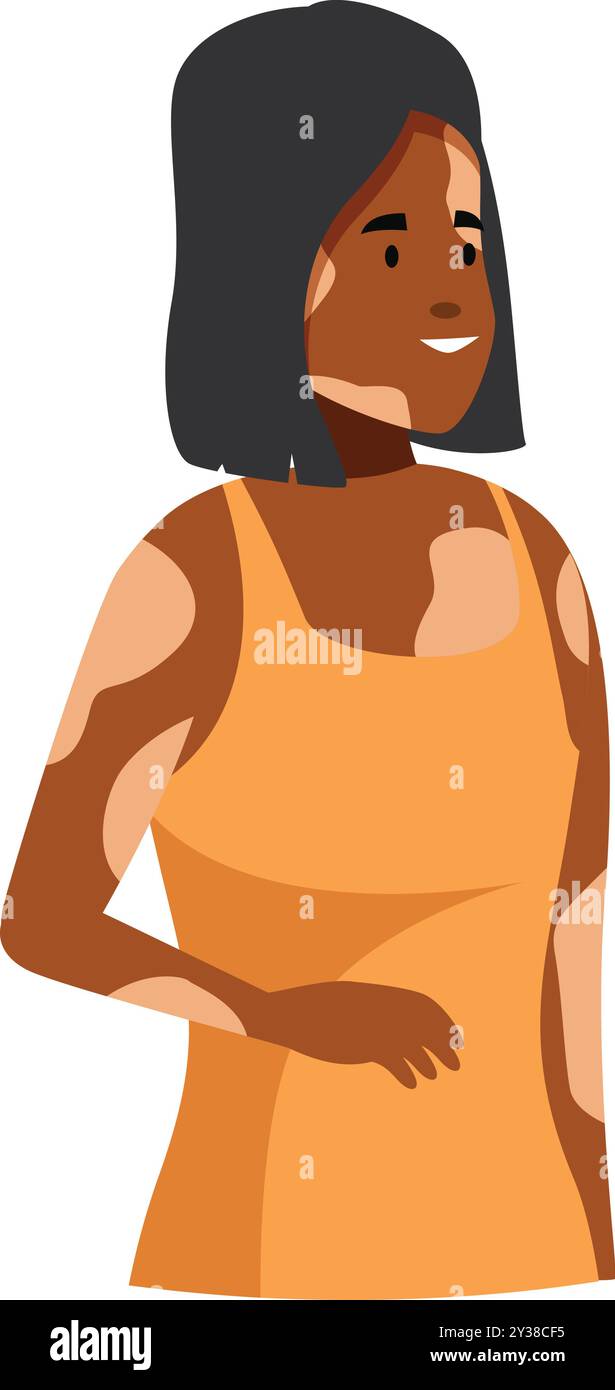 Smiling young black woman with vitiligo wearing a yellow dress Stock ...