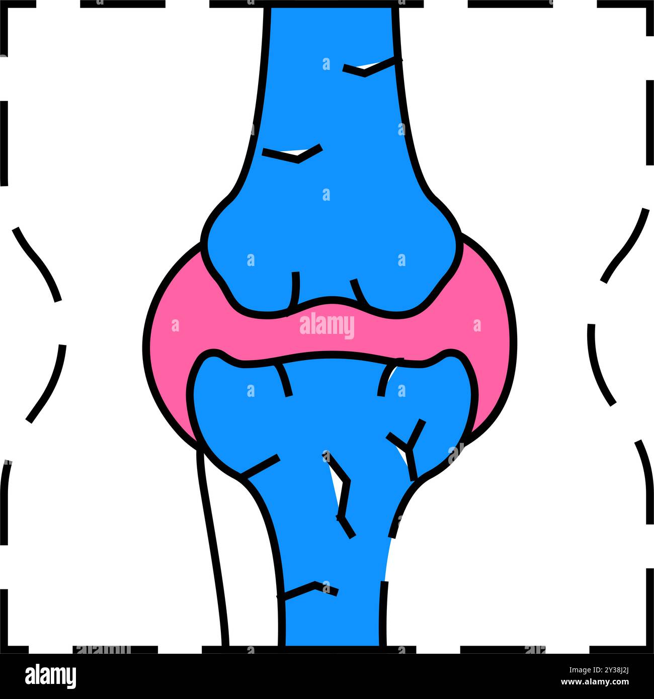 joint problem flat icon color illustration Stock Vector Image & Art - Alamy