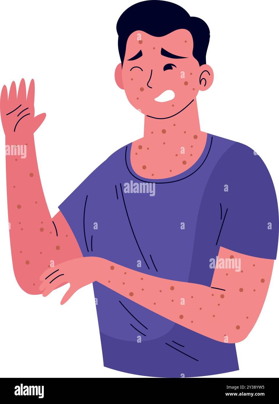 man character with monkeypox virus Stock Vector Image & Art - Alamy