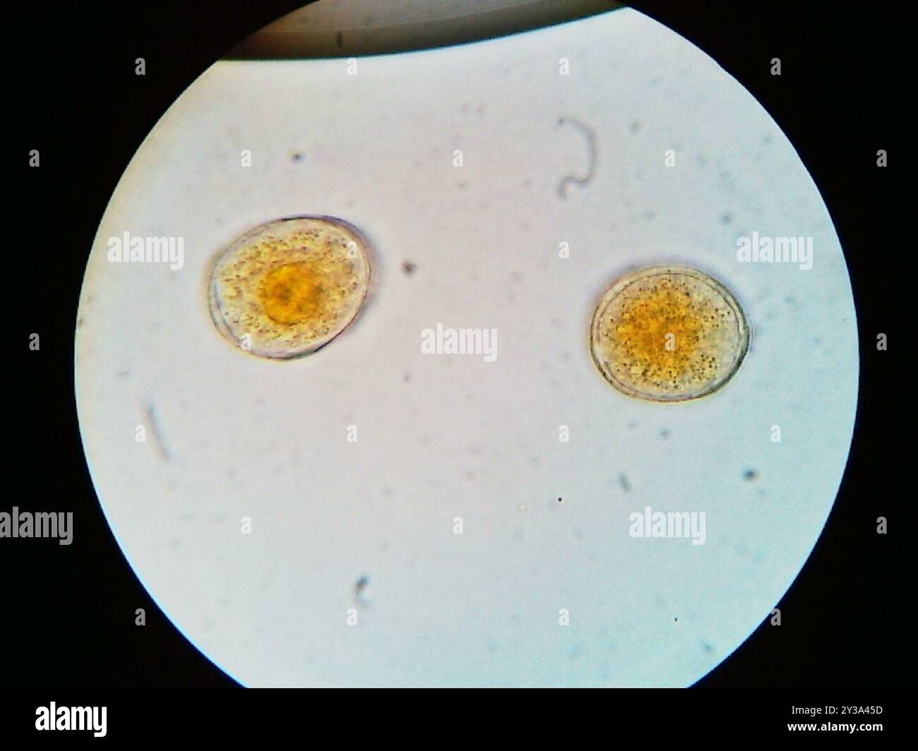 Asparagus rust (Puccinia asparagi) Fungi Stock Photo - Alamy