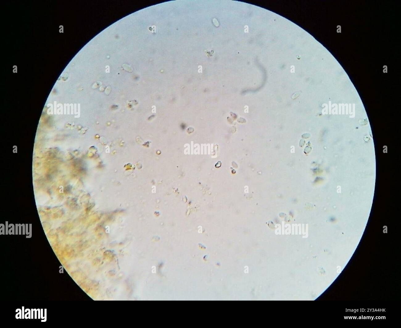 white pine blister rust (Cronartium ribicola) Fungi Stock Photo - Alamy