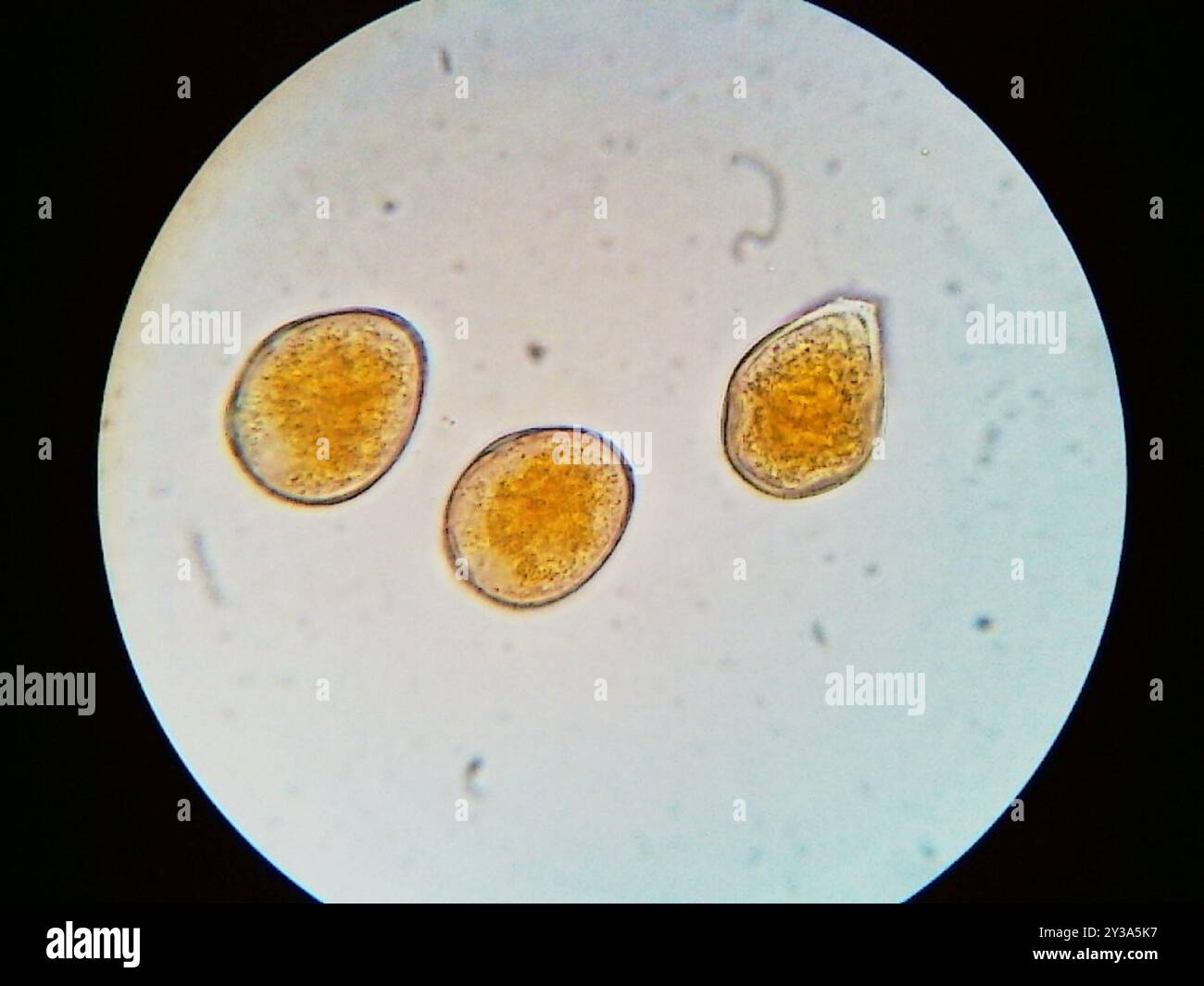 Asparagus rust (Puccinia asparagi) Fungi Stock Photo - Alamy