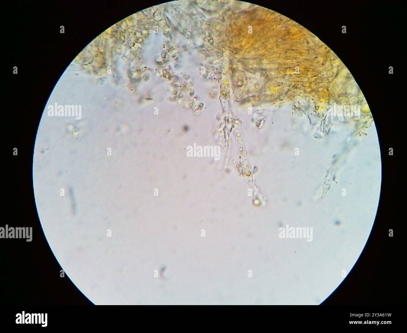 white pine blister rust (Cronartium ribicola) Fungi Stock Photo - Alamy