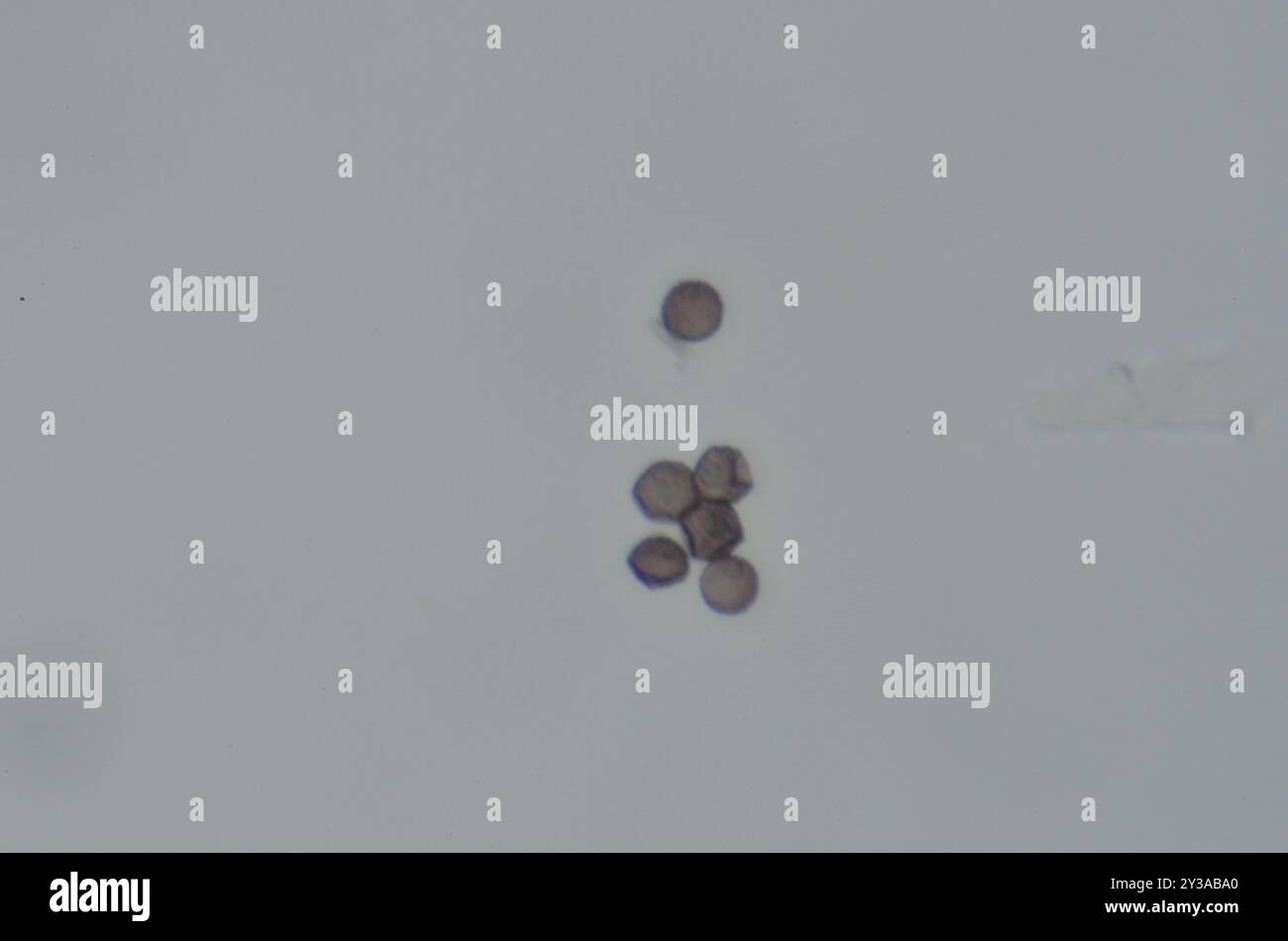 slime molds (Mycetozoa) Protozoa Stock Photo - Alamy