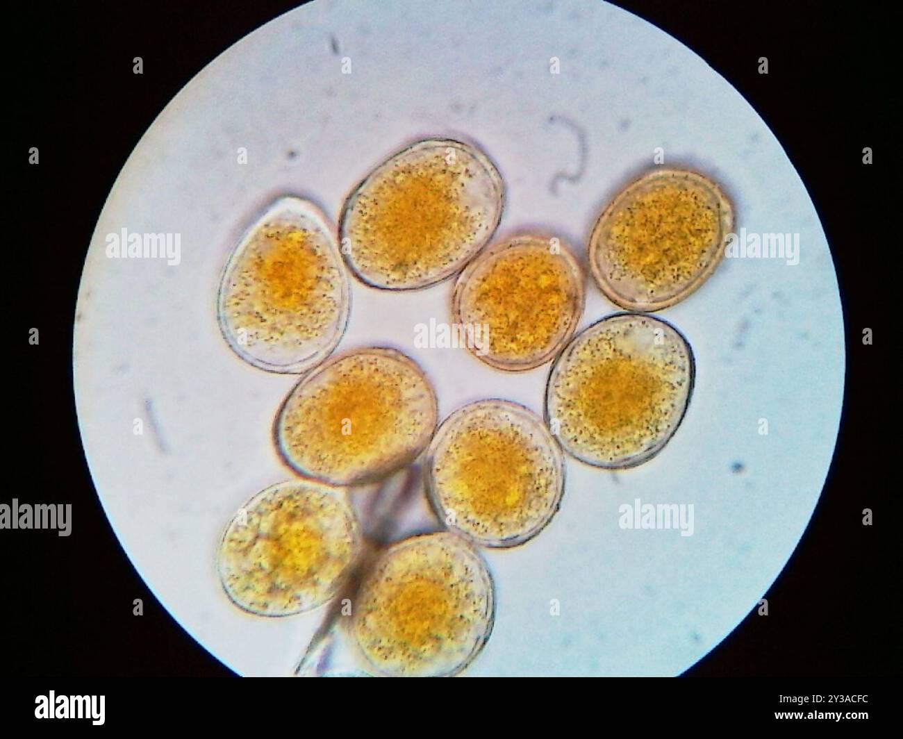 Asparagus rust (Puccinia asparagi) Fungi Stock Photo - Alamy