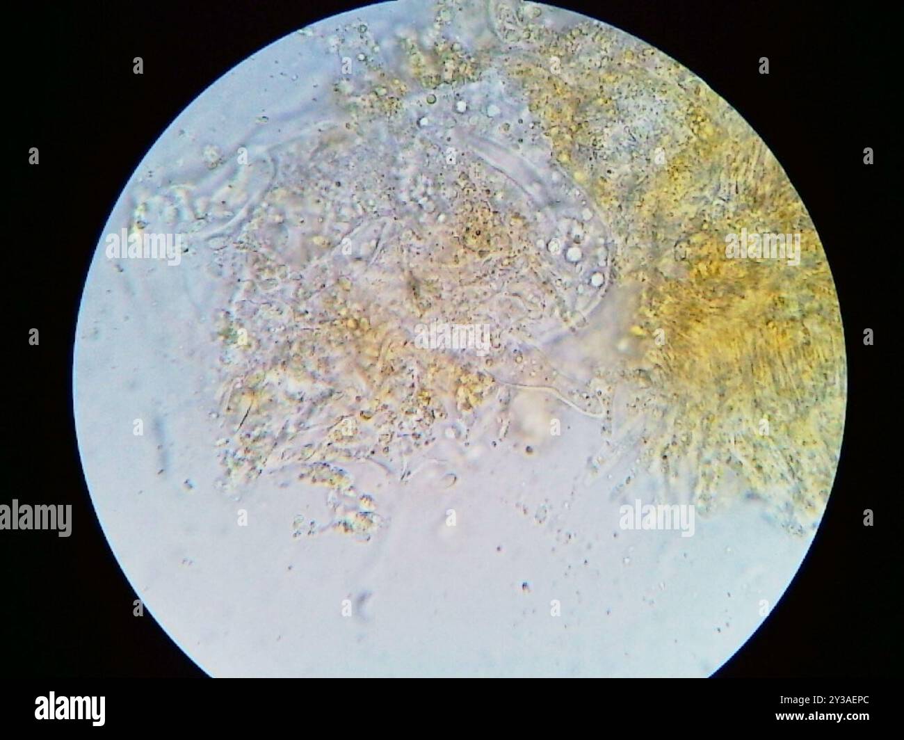 white pine blister rust (Cronartium ribicola) Fungi Stock Photo - Alamy