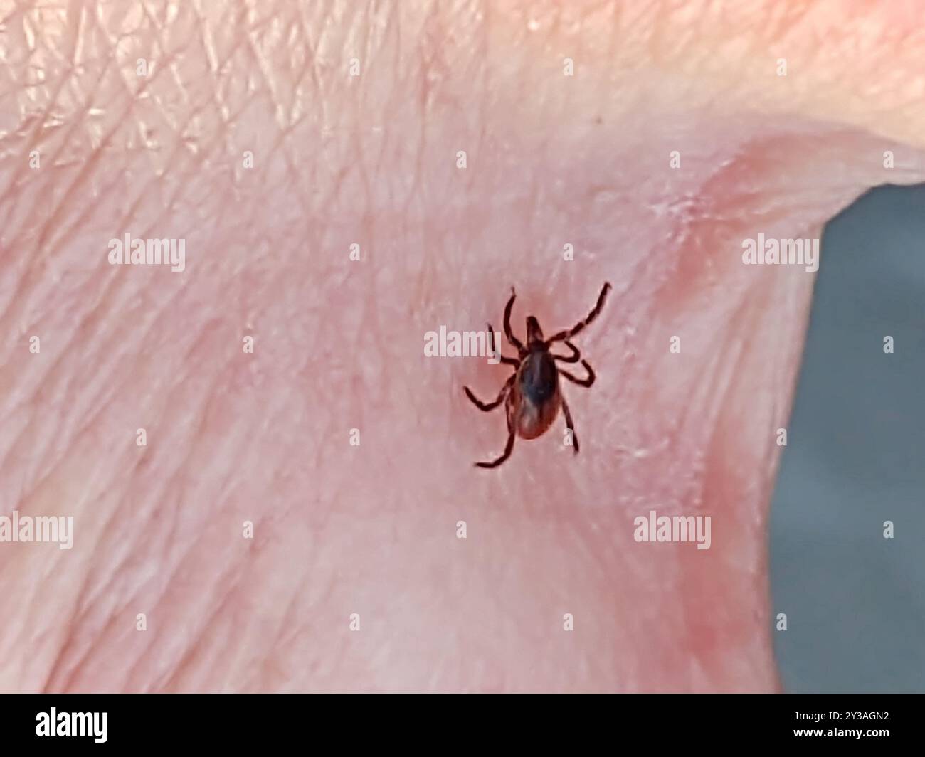 Eastern Black-legged Tick (Ixodes scapularis) Arachnida Stock Photo - Alamy