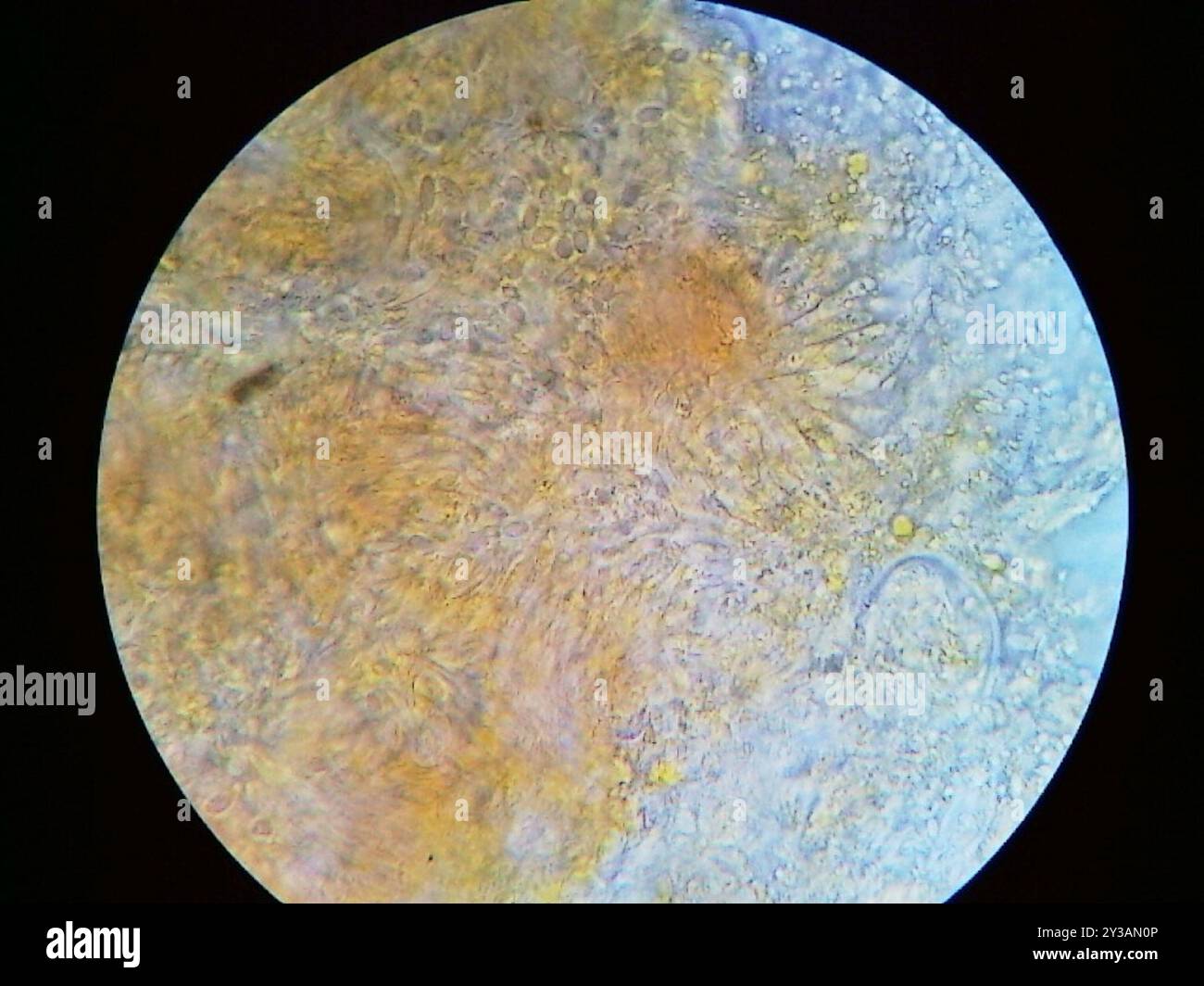 white pine blister rust (Cronartium ribicola) Fungi Stock Photo - Alamy