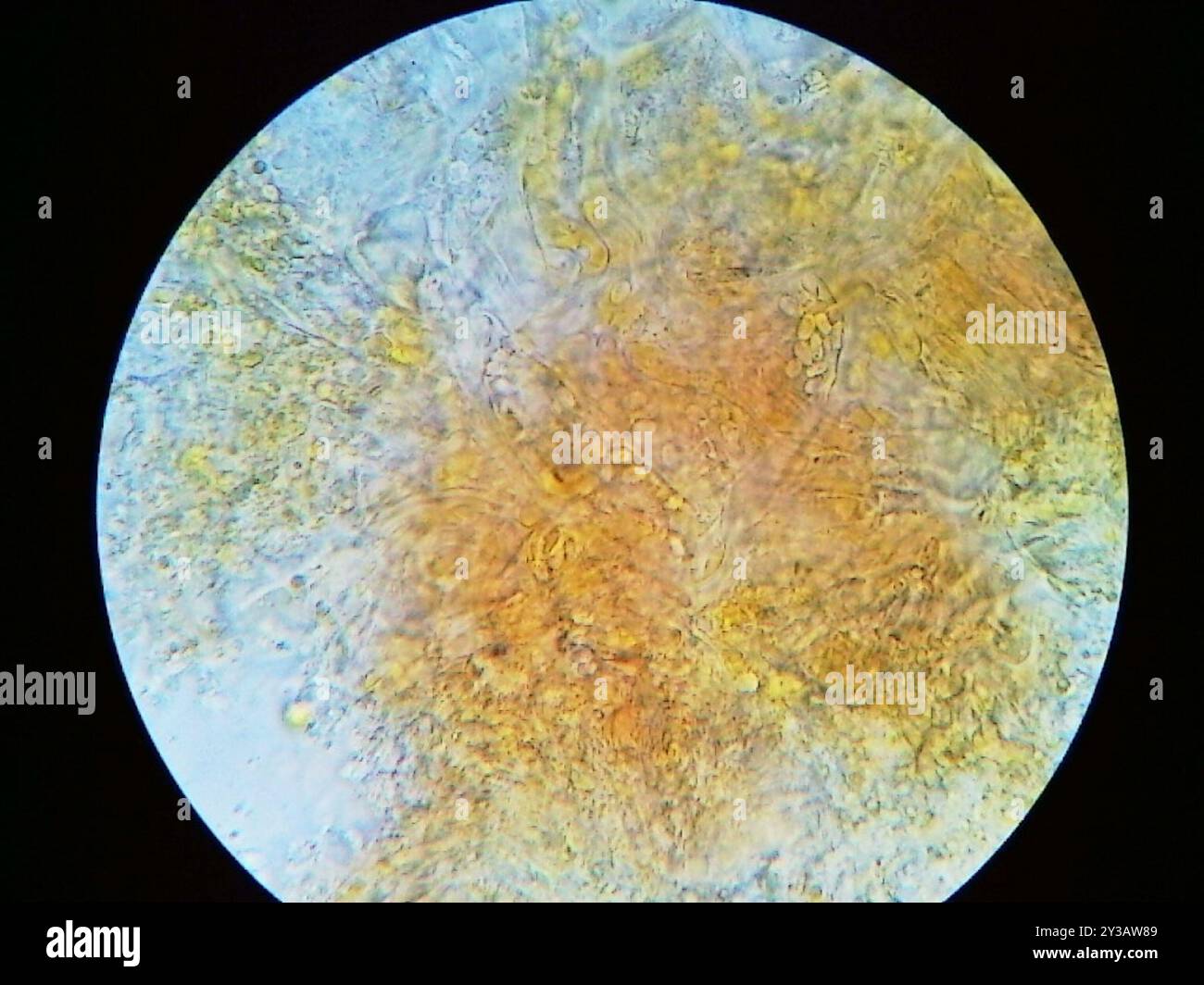 white pine blister rust (Cronartium ribicola) Fungi Stock Photo - Alamy