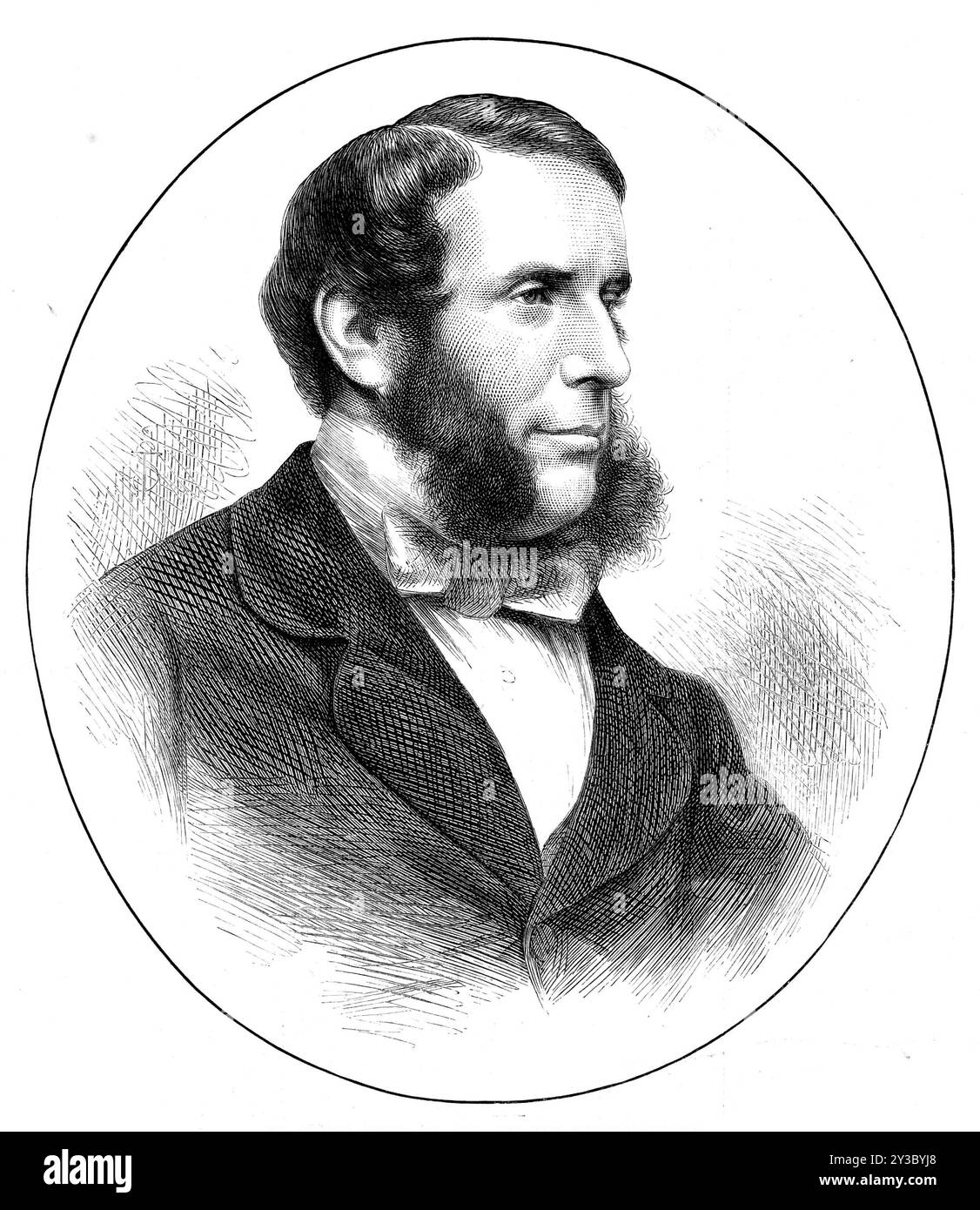 Joseph merrick hi-res stock photography and images - Alamy