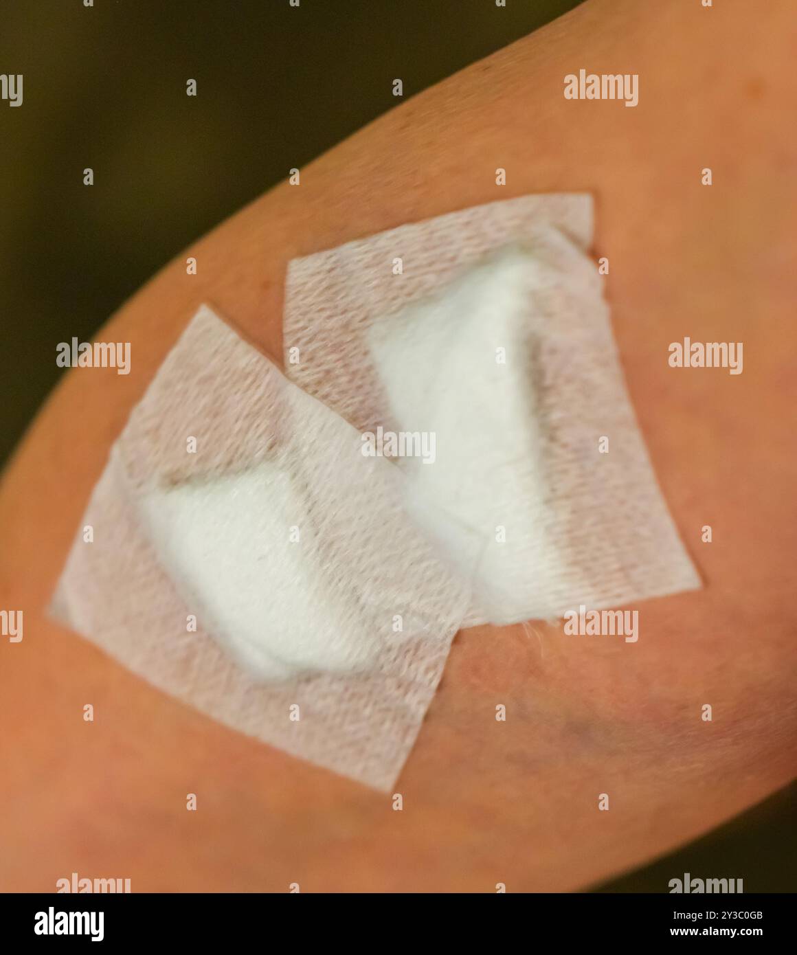 Irritation surgery hi-res stock photography and images - Alamy