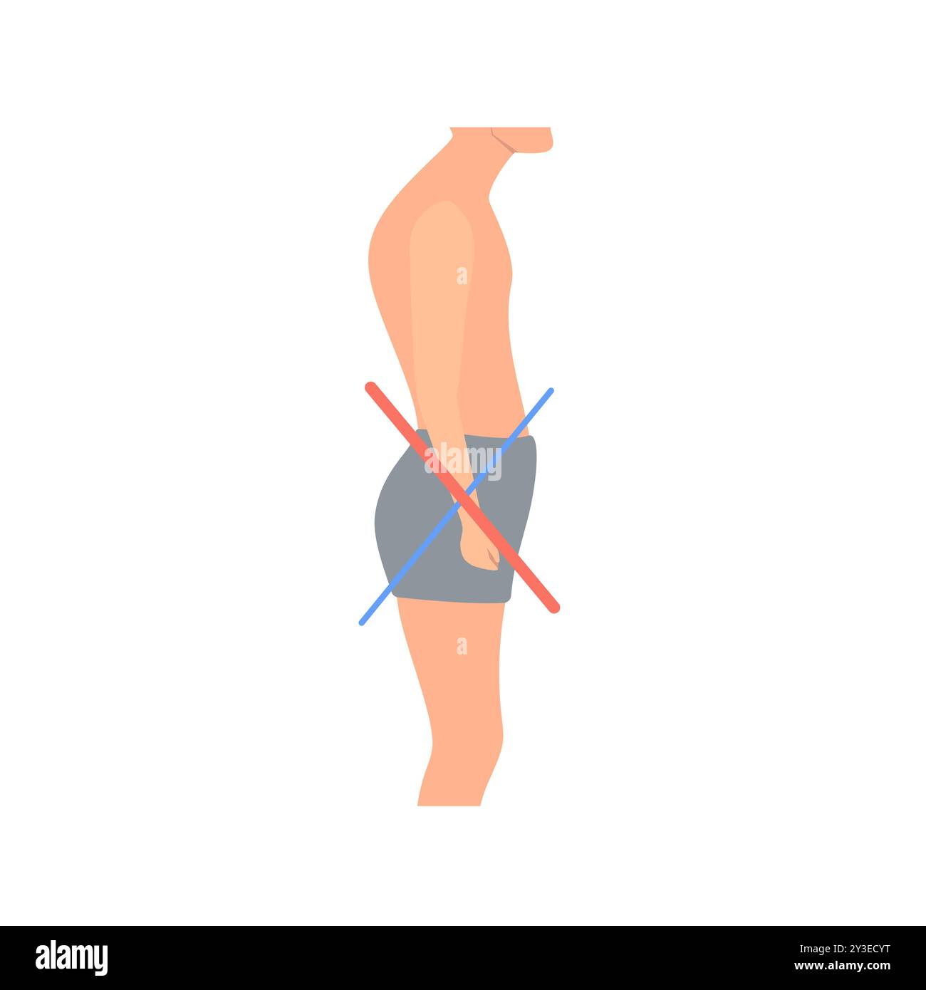 Crooked man with lower crossed syndrome imbalance Stock Vector Image ...