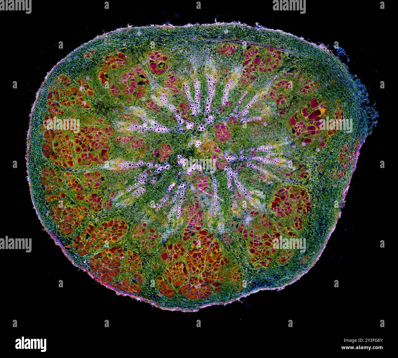 Clubroot in cabbage root, Plasmodiophora brassicae Stock Photo - Alamy